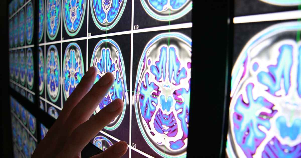 Neurosciences - SILS - University of Amsterdam